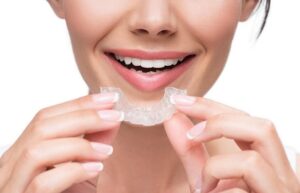 Get An Affordable Smile MakeOver With makeO toothsi Clear Aligners ...